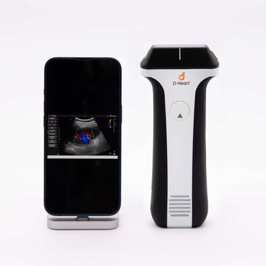 D-Heart Linear Scanner – d-heartcare