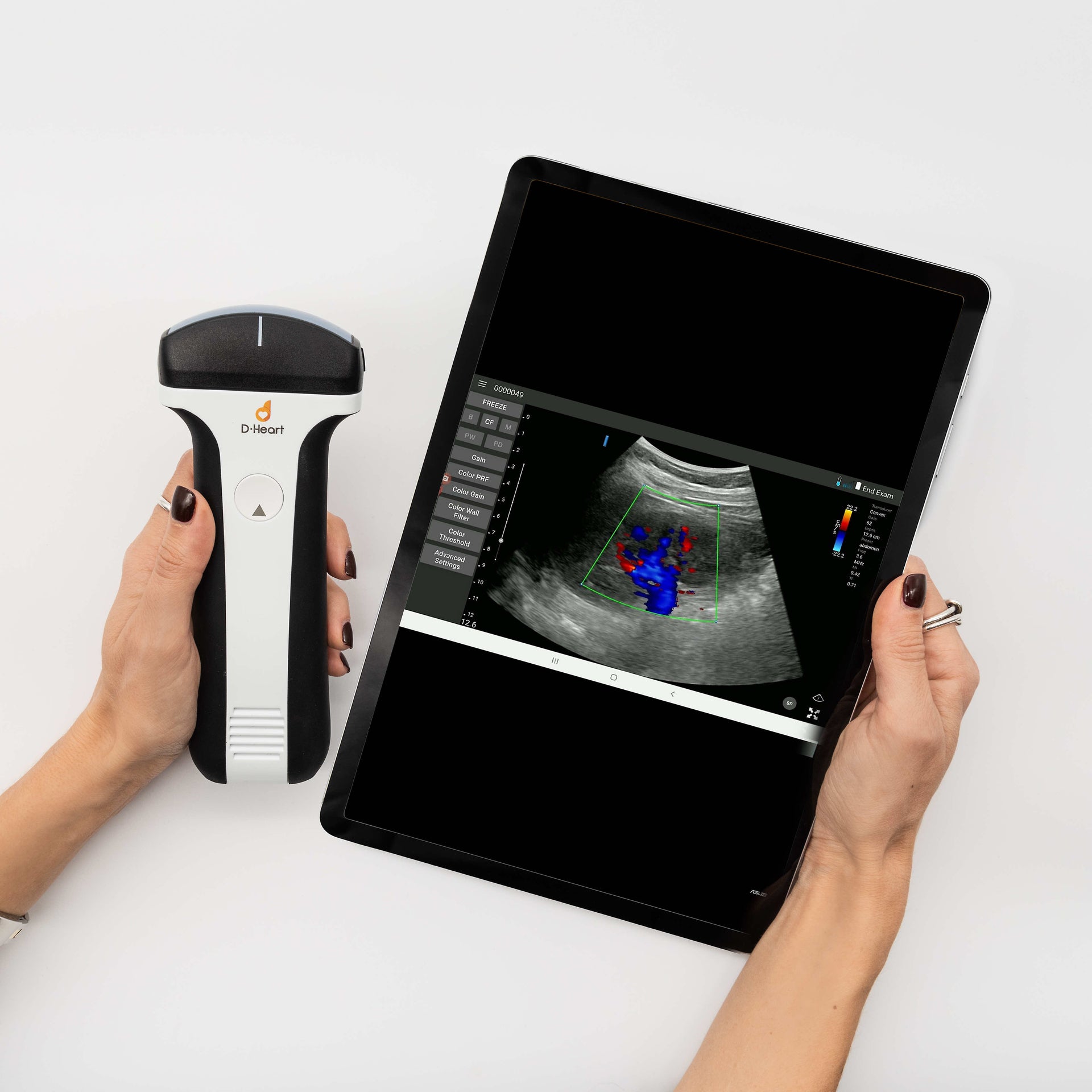 D-Heart Convex Scanner – d-heartcare