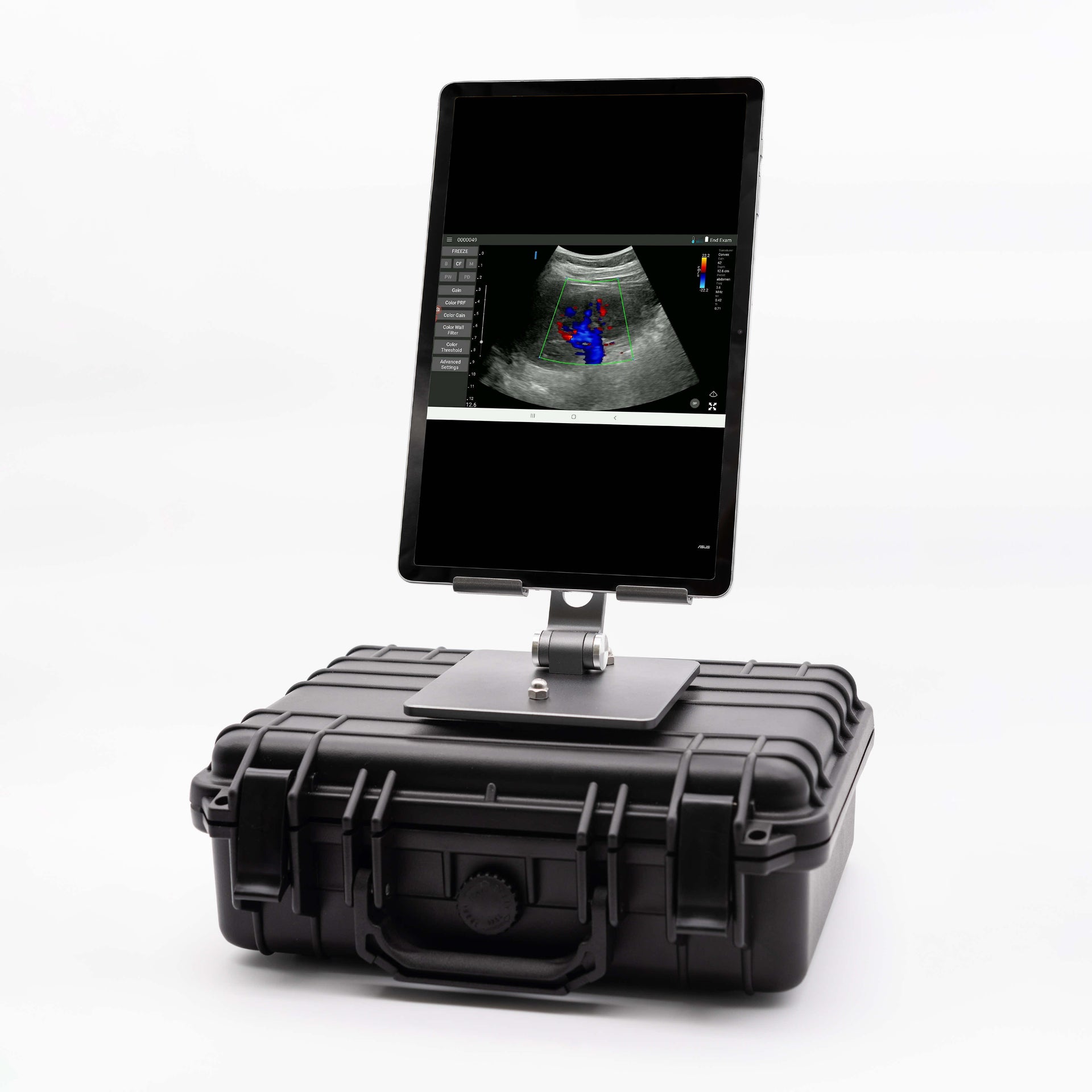 D-Heart Convex Scanner – d-heartcare